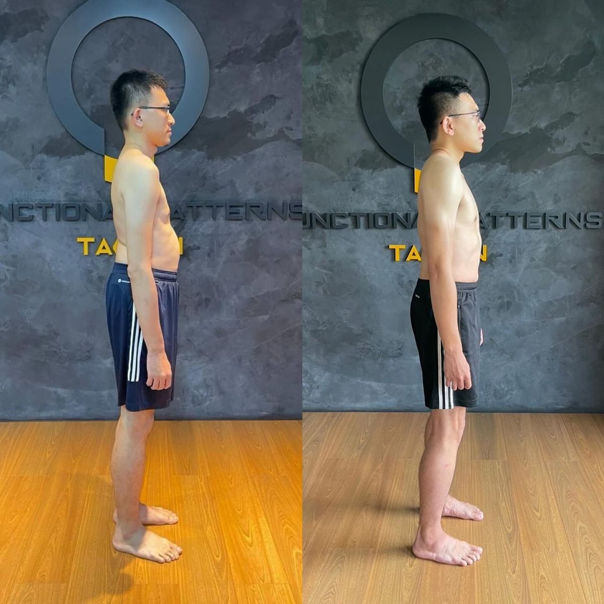 「脊椎側彎Scoliosis的運動方法-Part2 」 | Functional Patterns Taiwan