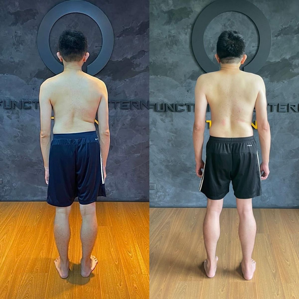 「脊椎側彎Scoliosis的運動方法-Part2 」 | Functional Patterns Taiwan