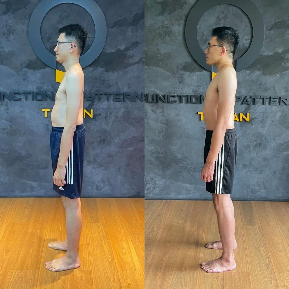 「脊椎側彎Scoliosis的運動方法-Part2 」 | Functional Patterns Taiwan